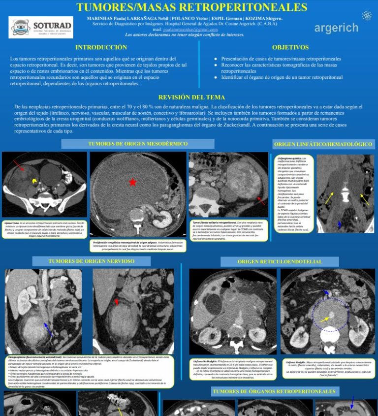 Tumores/Masas Retroperitoneales - Sociedad Tucumana de Radiología ...